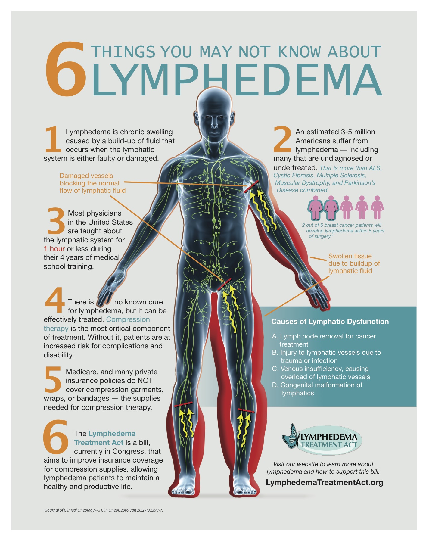 Raising Awareness For Lymphedema The Bridge Raising Awareness For Lymphedema The Bridge